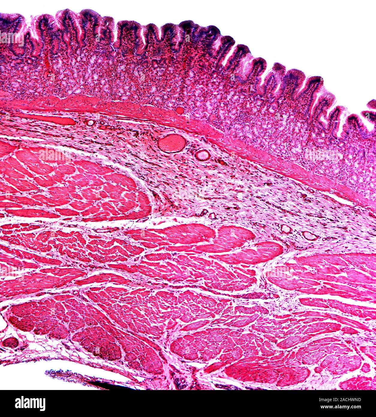 Small intestine section. Light micrograph of a vertical section through ...