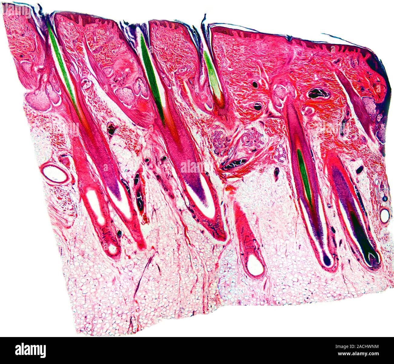 Skin section. Semi-polarised light micrograph of a vertical section ...