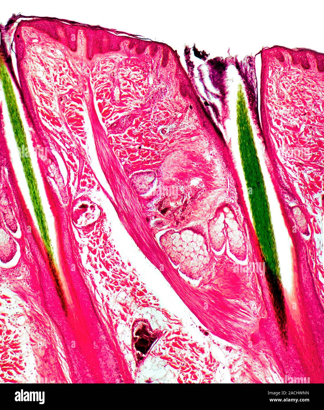 Skin section. Semi-polarised light micrograph of a vertical section ...