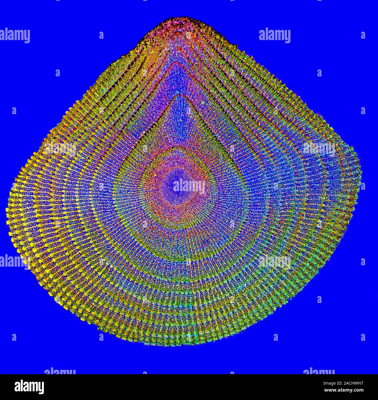 Sea urchin spine. Polarised light micrograph of a cross-section through ...