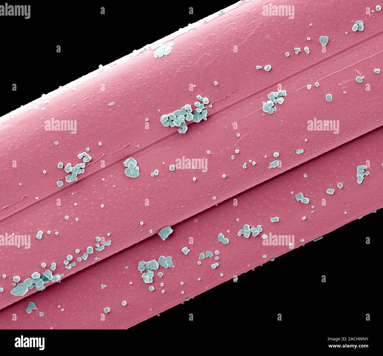 Antimicrobial wound dressing. Coloured scanning electron micrograph ...
