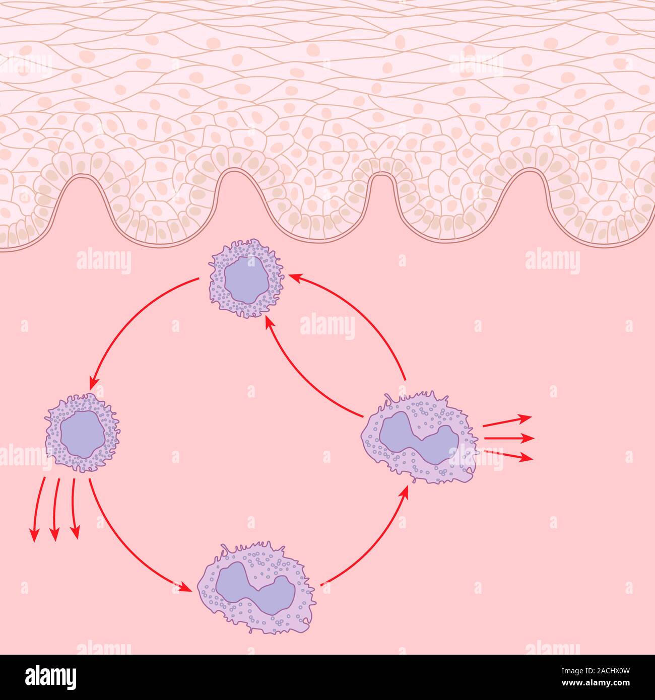 Immune response to chronic inflammation. Computer artwork showing the ...