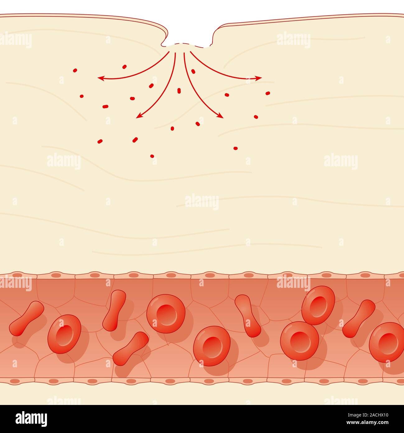 Skin damage immune response. Computer artwork showing the body's immune ...