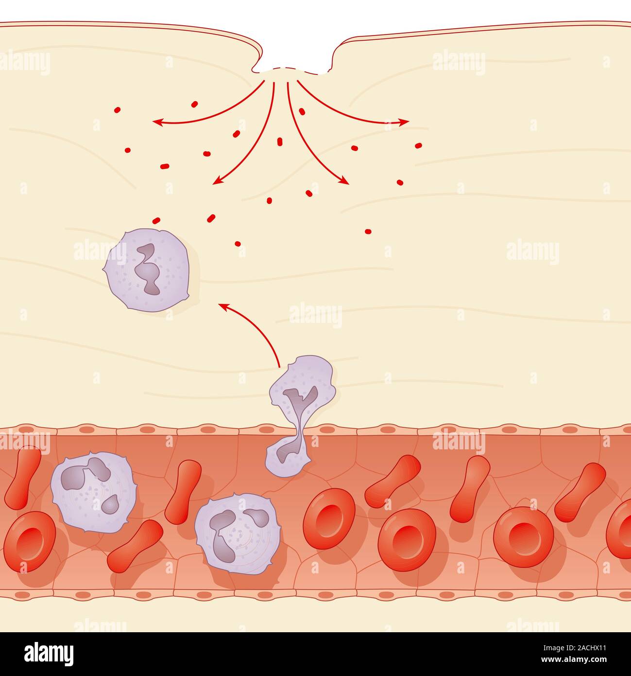 Skin damage immune response. Computer artwork showing the body's immune ...