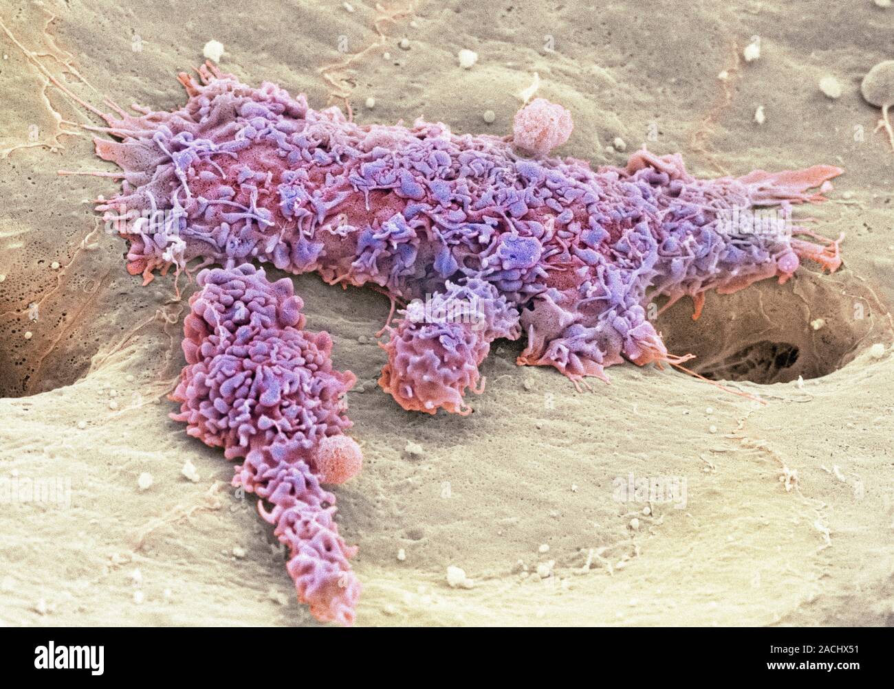 Liver macrophage cells. Coloured scanning electron micrograph (SEM) of ...