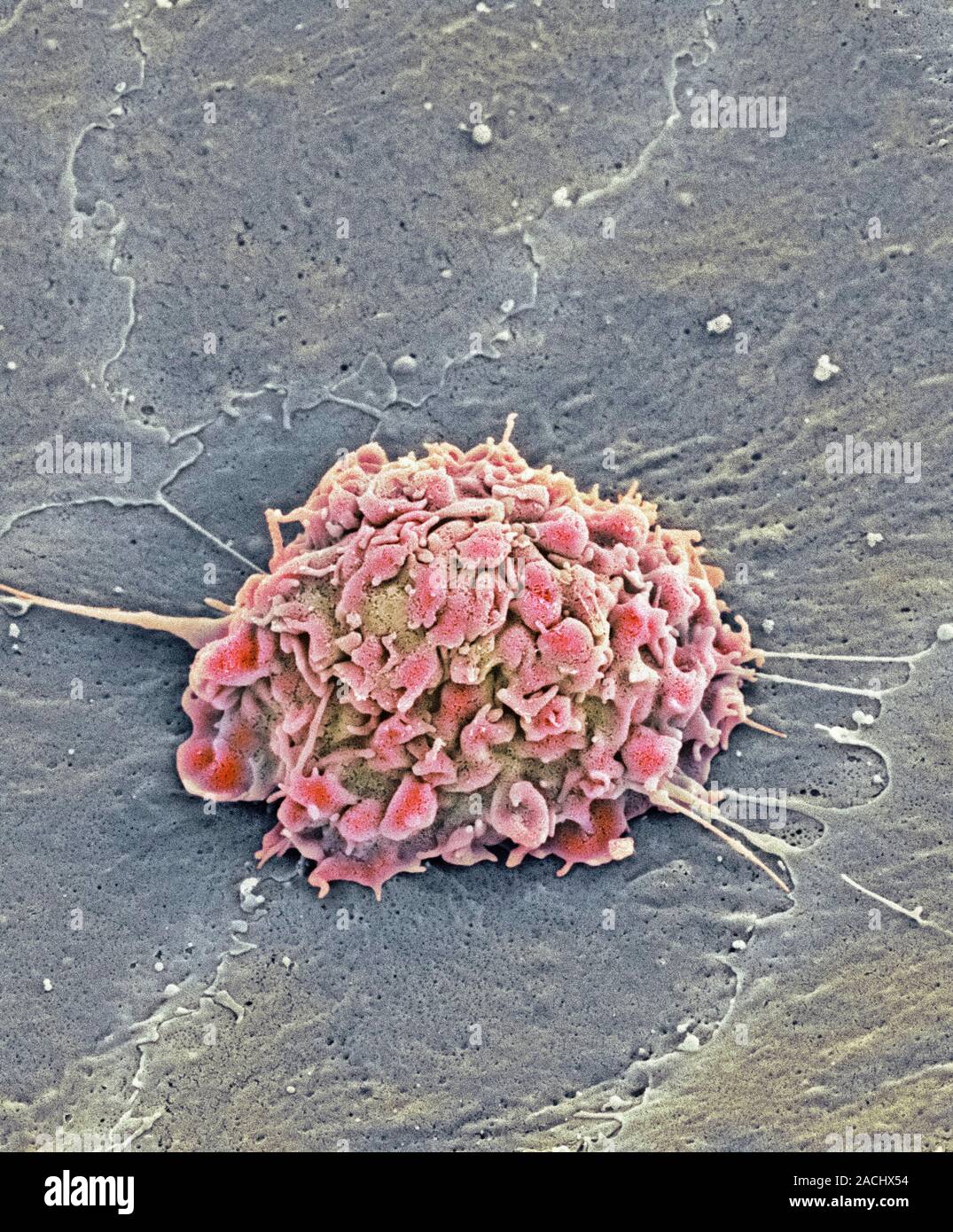 Liver macrophage cell. Coloured scanning electron micrograph (SEM) of a ...