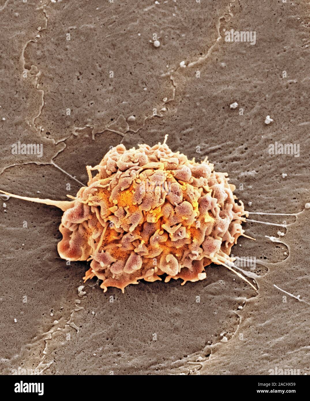 Liver macrophage cell. Coloured scanning electron micrograph (SEM) of a ...