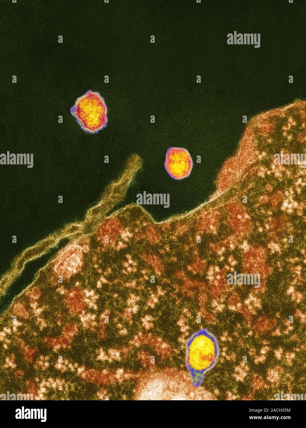 Hepatitis C viruses. Coloured transmission electron micrograph (TEM) of ...