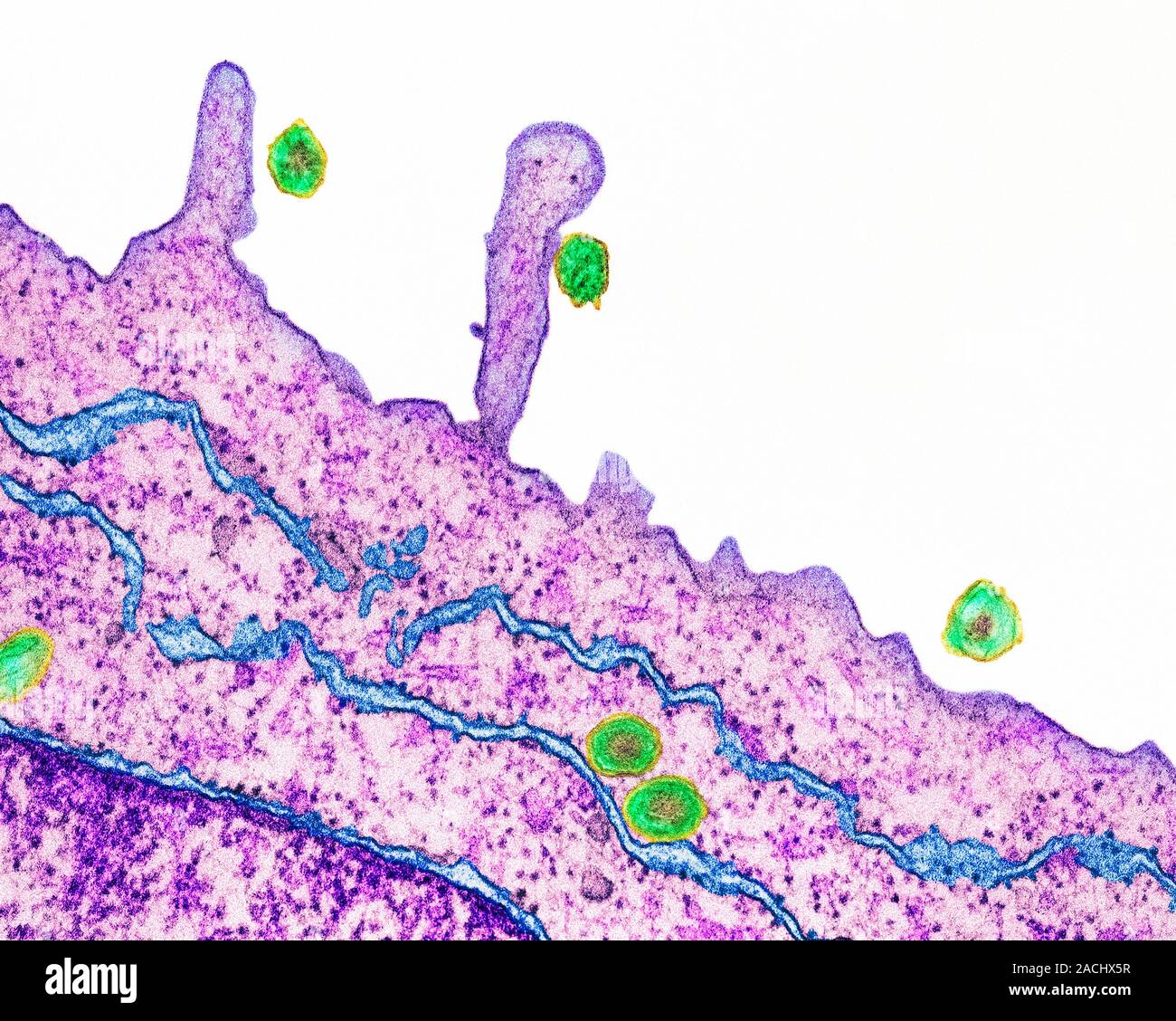 Hepatitis C viruses. Coloured transmission electron micrograph (TEM) of ...