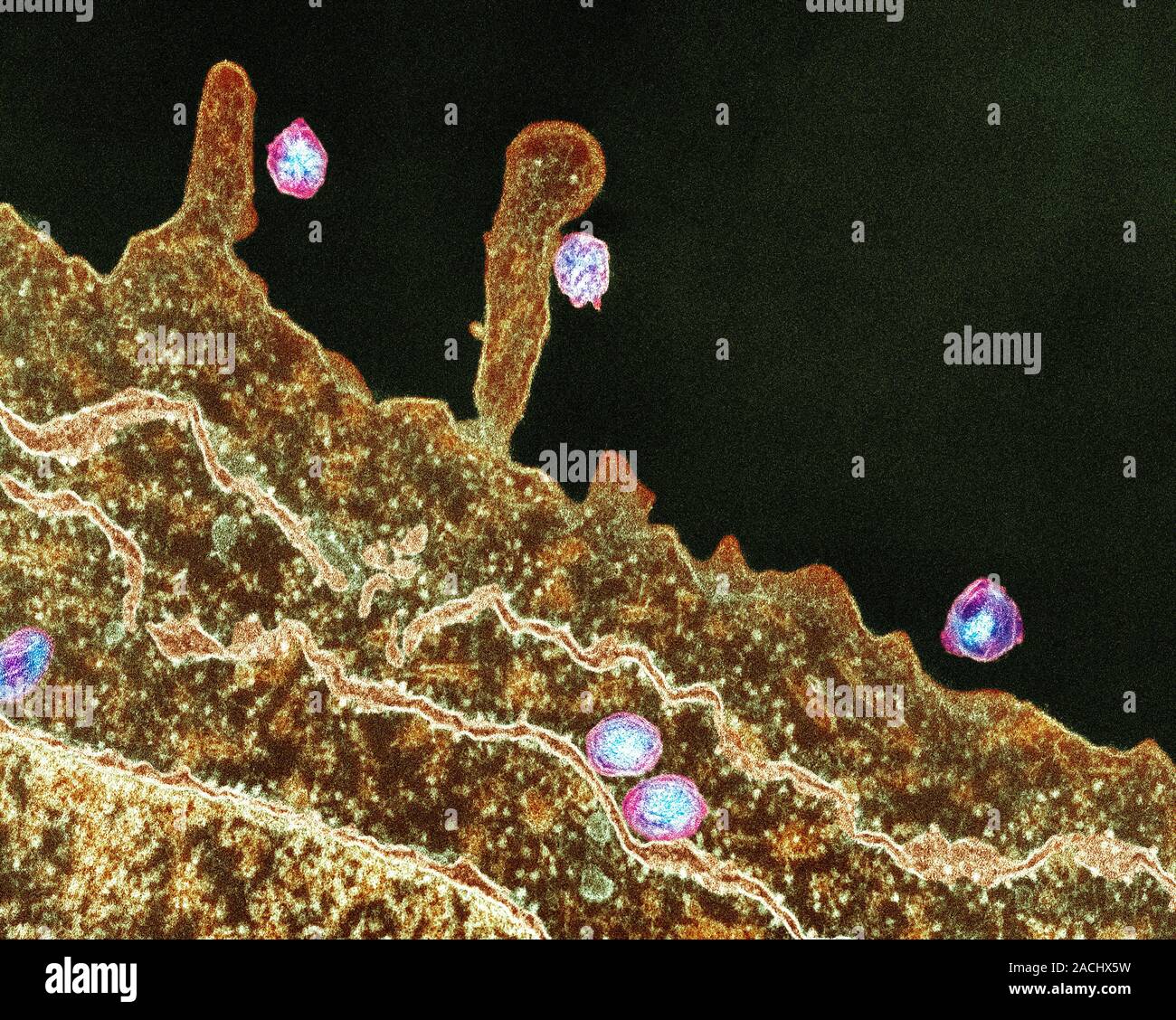 Hepatitis C viruses. Coloured transmission electron micrograph (TEM) of ...