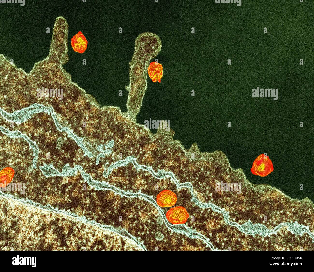 Hepatitis C viruses. Coloured transmission electron micrograph (TEM) of ...
