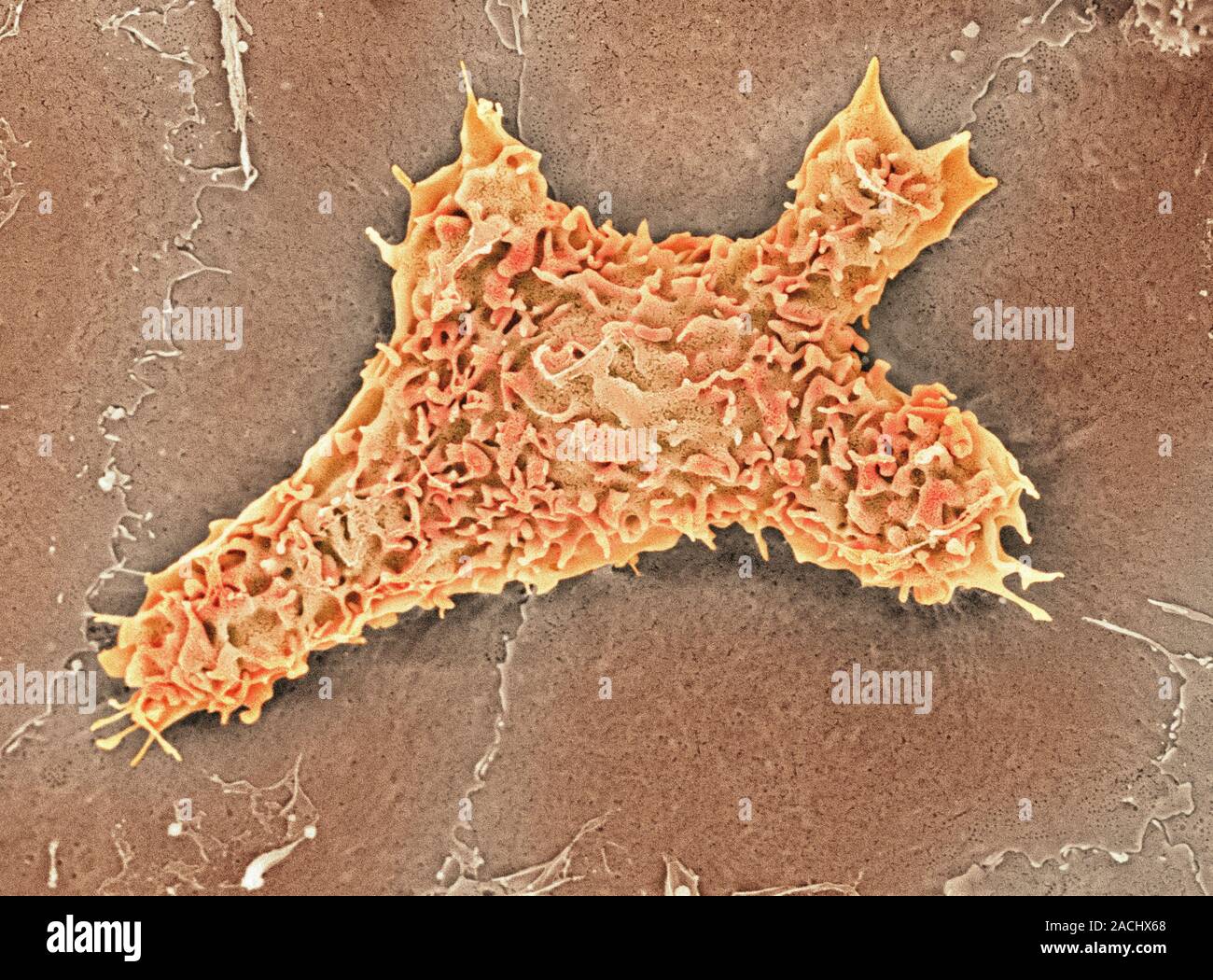 Macrophage cell. Coloured scanning electron micrograph (SEM) of a macrophage white blood cell ...