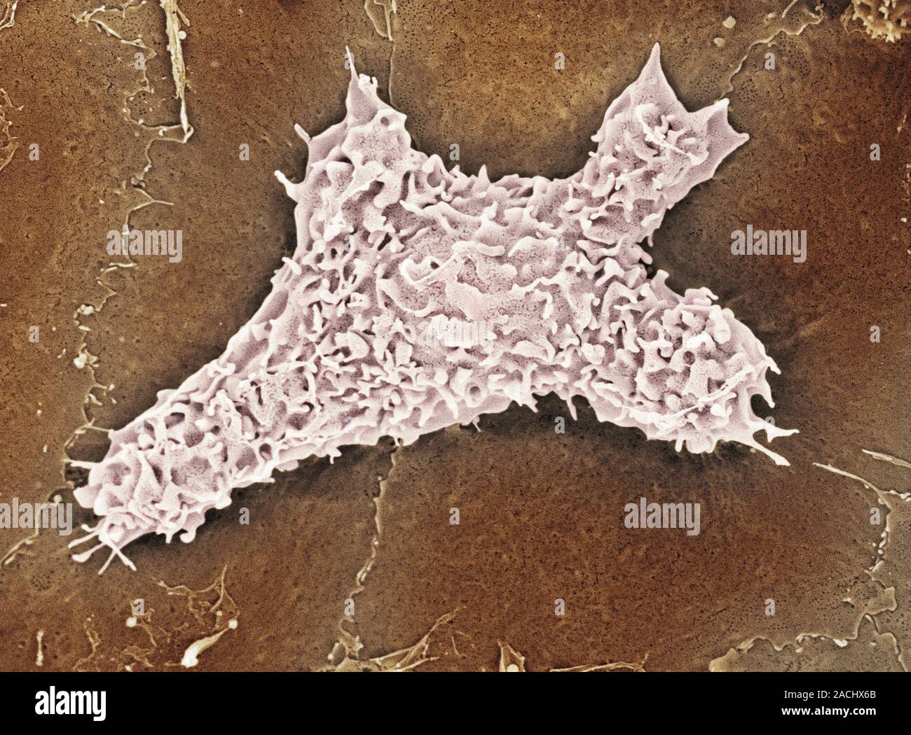Macrophage cell. Coloured scanning electron micrograph (SEM) of a macrophage white blood cell ...