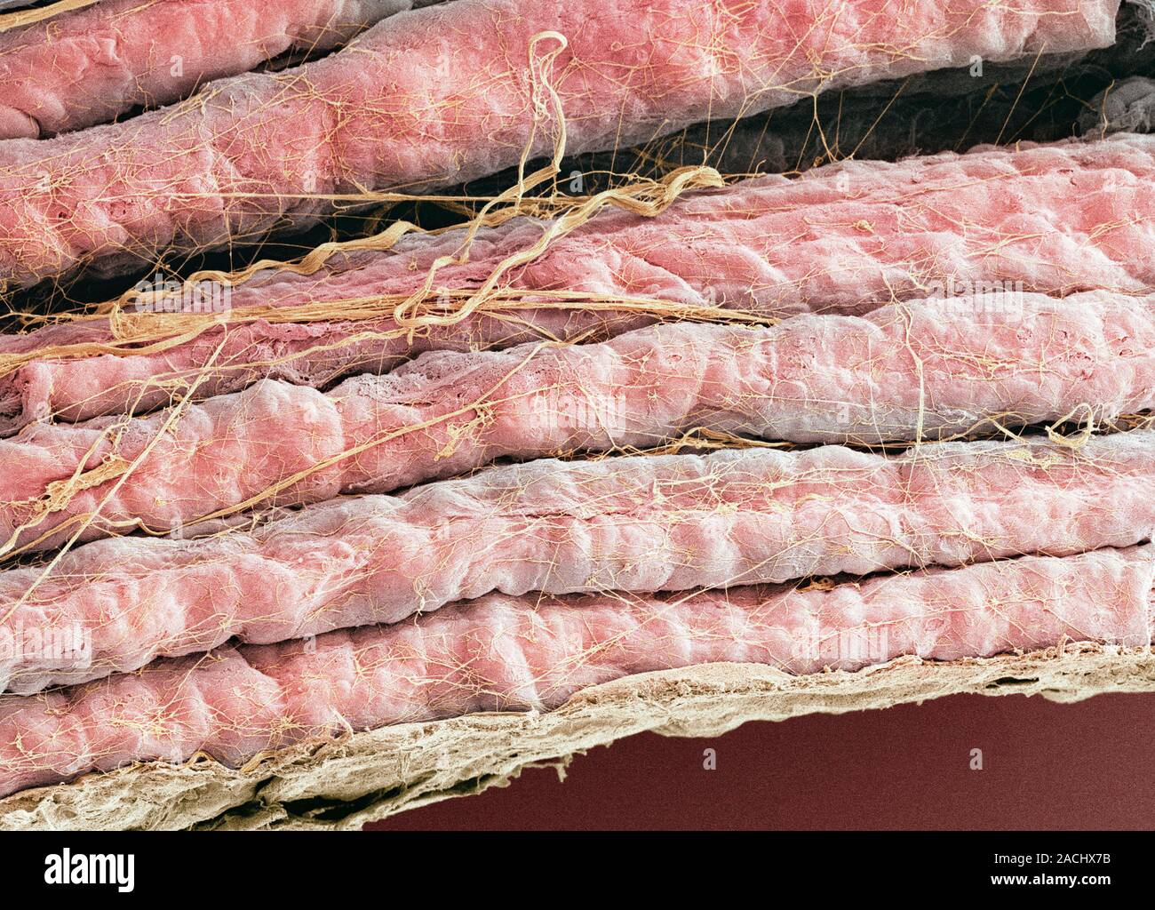 Myelinated nerves. Coloured scanning electron micrograph (SEM) of ...