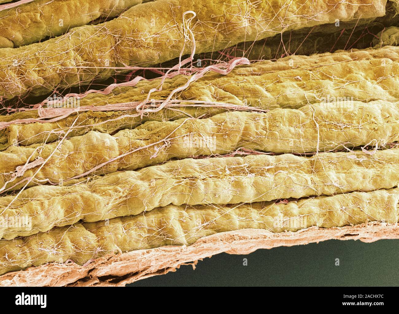 Myelinated nerves. Coloured scanning electron micrograph (SEM) of ...