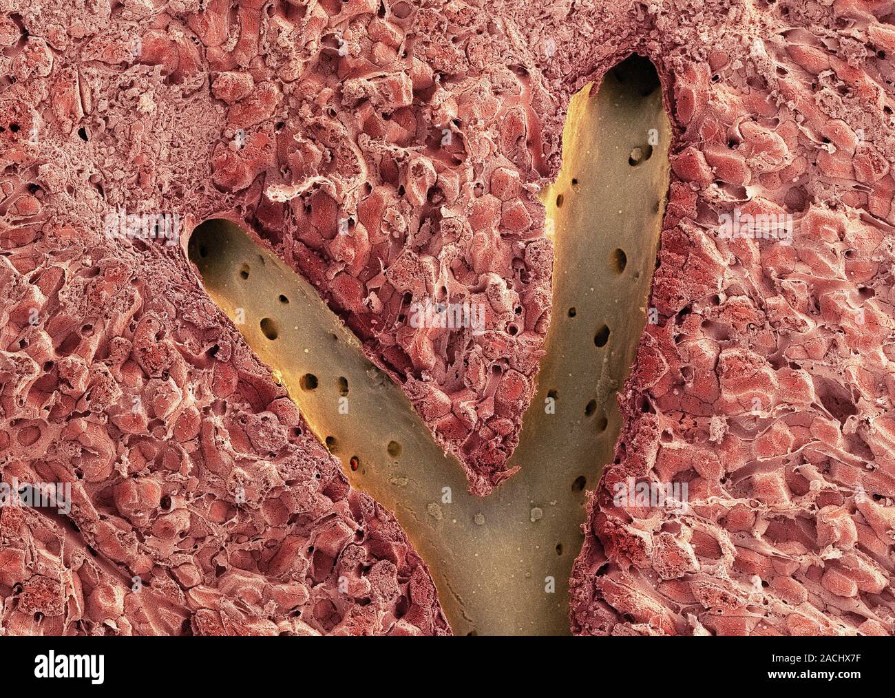 Liver Vein Coloured Scanning Electron Micrograph Sem Of A Section Through Liver Tissue