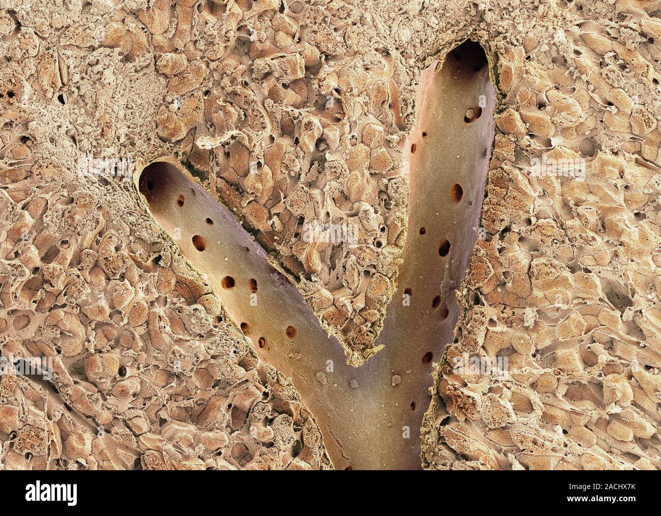 Liver vein. Coloured scanning electron micrograph (SEM) of a section ...
