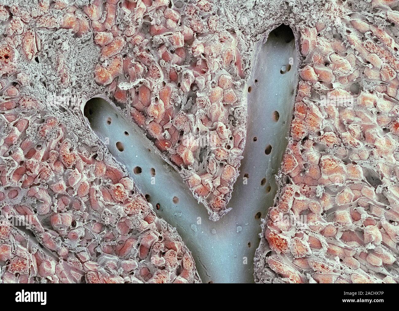 Liver vein. Coloured scanning electron micrograph (SEM) of a section ...