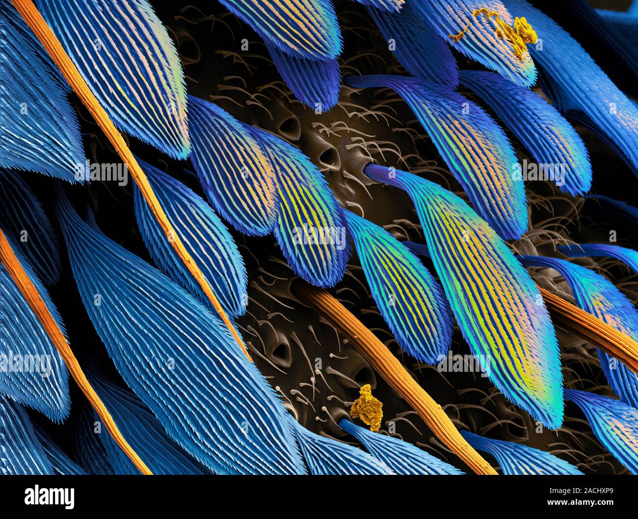 Body bristles (blue) of a whitefly (family Aleyrodidae), coloured ...