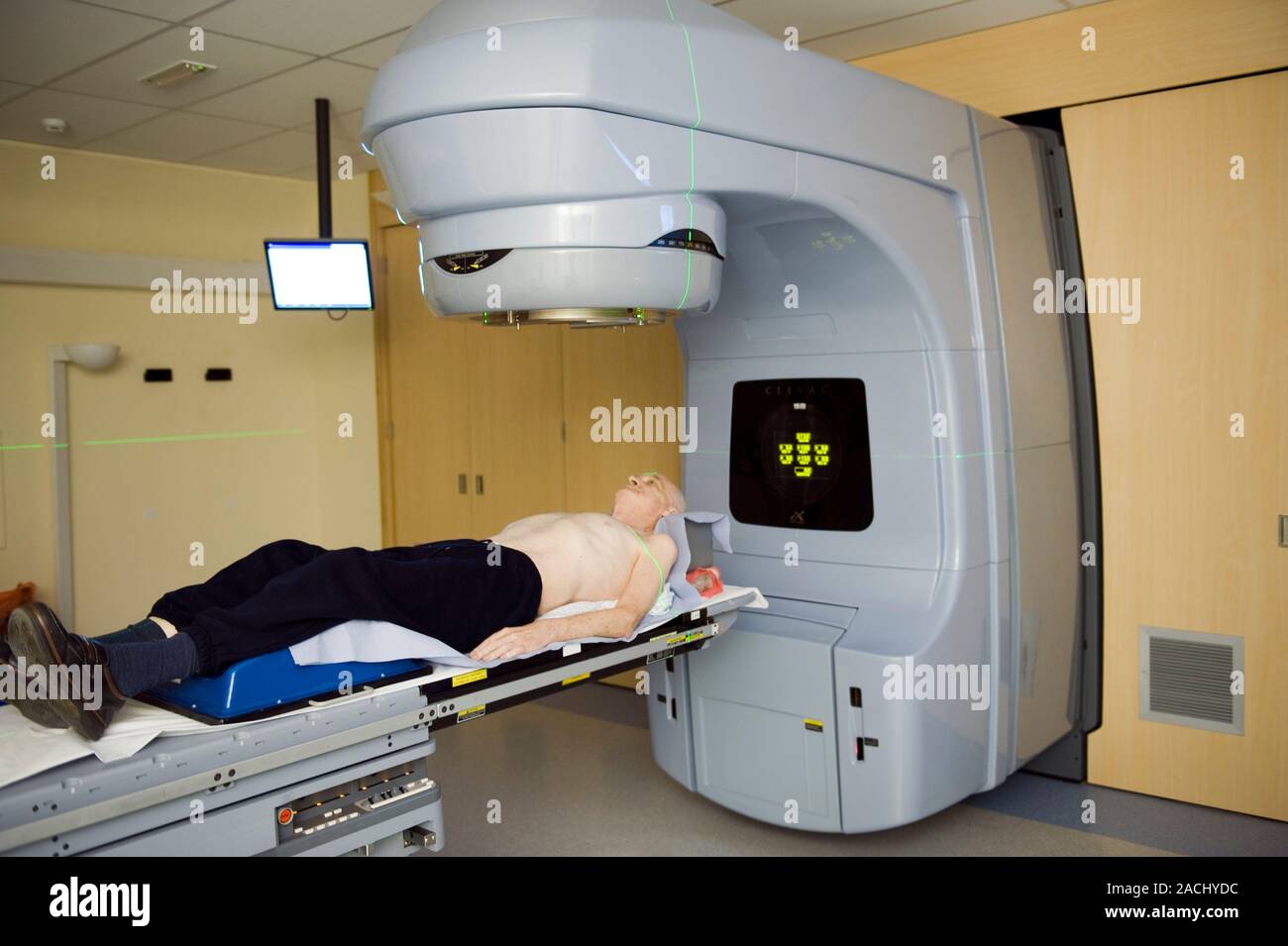 Lung cancer radiotherapy (radiation treatment) being conducted on an ...
