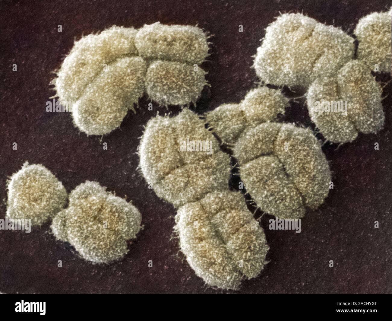 Group of human chromosomes, coloured scanning electron micrograph (SEM ...
