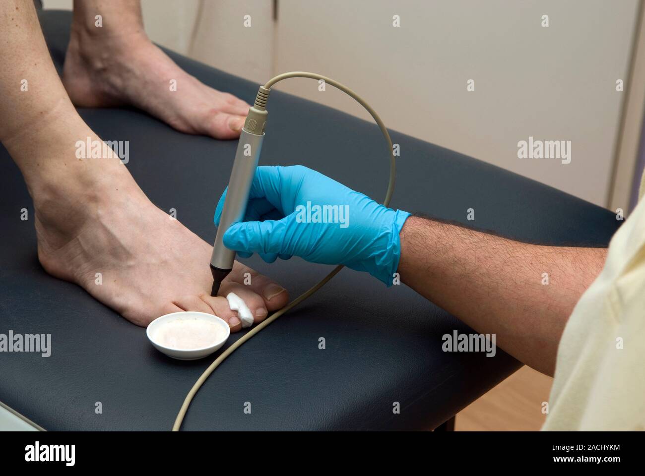 Electroacupuncture. This treatment is a form of acupuncture that uses ...