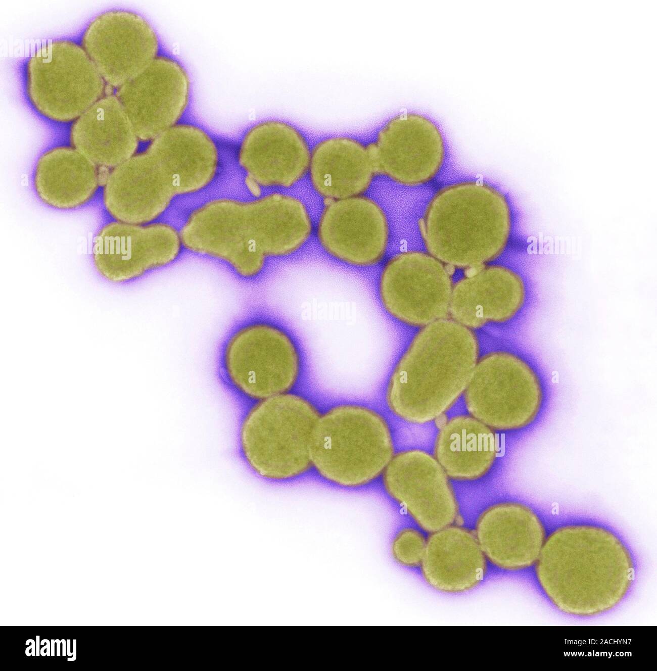 Synthetic Mycoplasma bacteria, coloured transmission electron ...