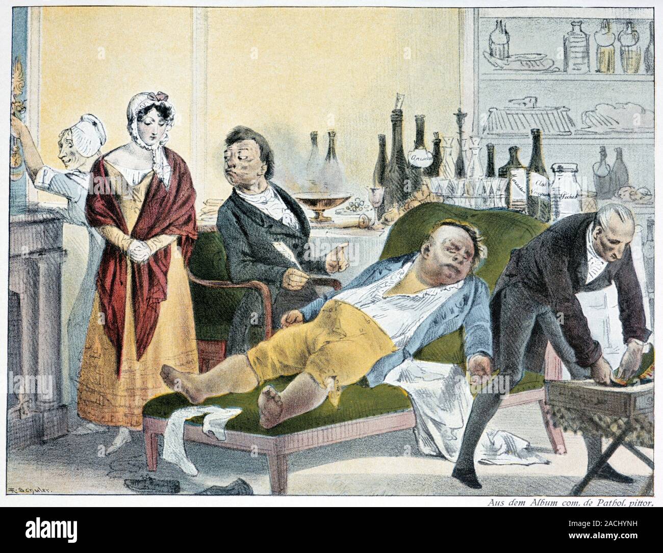 Stroke (apoplexy). Satirical artwork of a patient attended by his wife ...