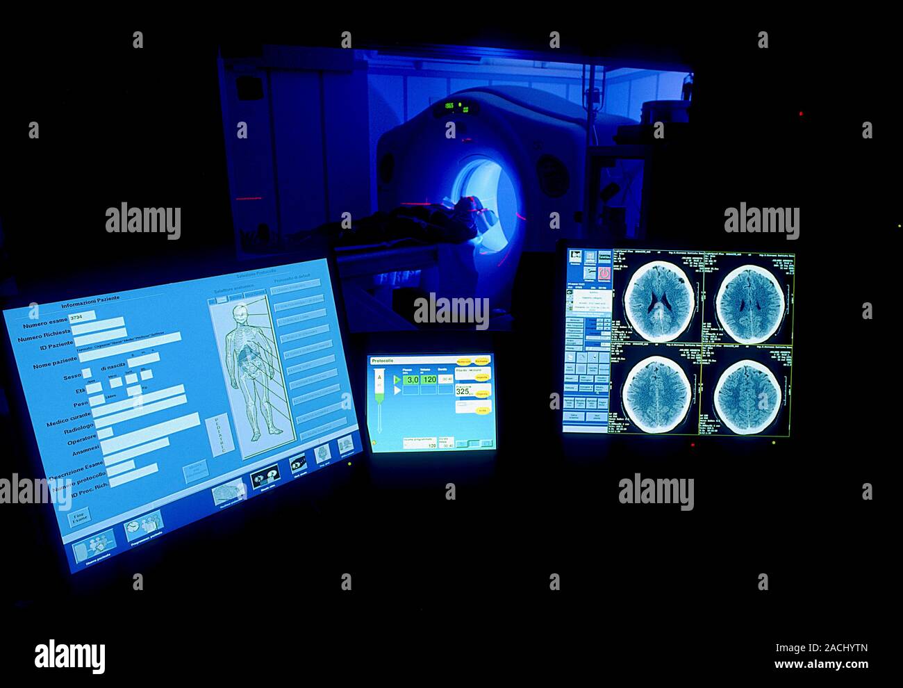 Coma patient being scanned. Advanced scanning techniques, such as ...
