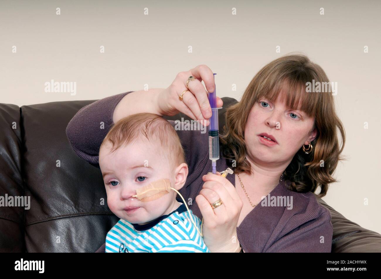 Nasogastric tube. 18-month-old infant being given medication by his ...