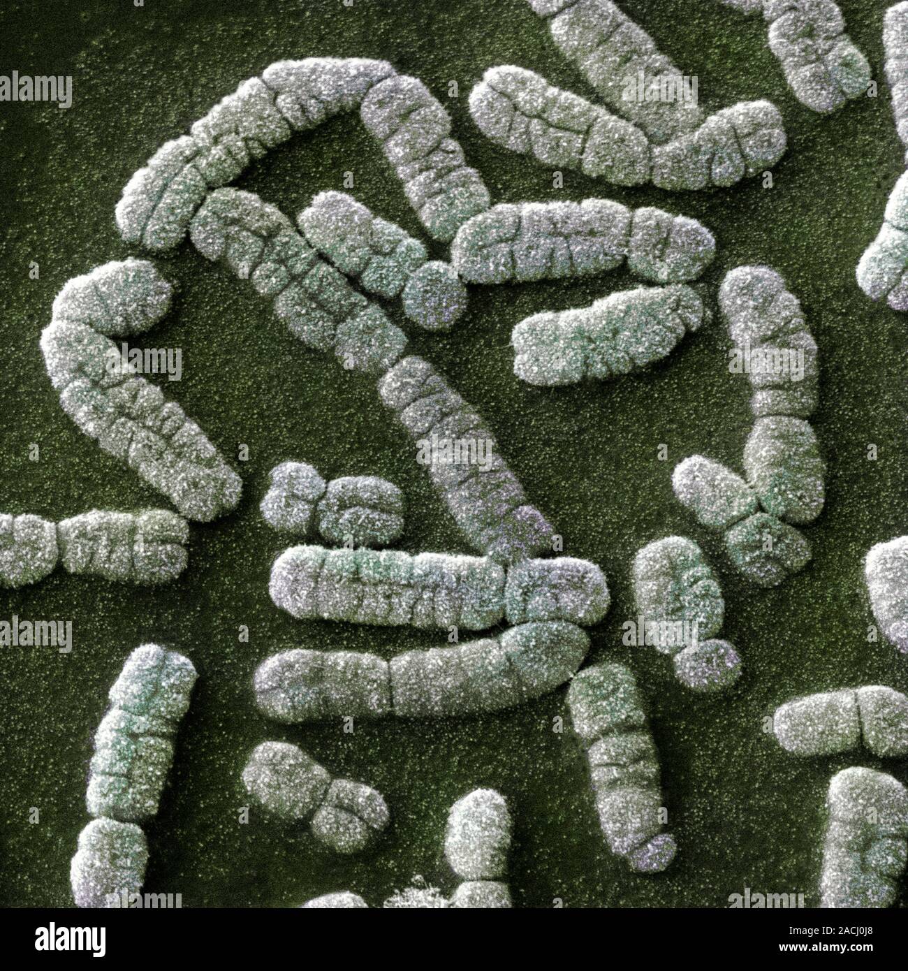 Group of human chromosomes, coloured scanning electron micrograph (SEM ...