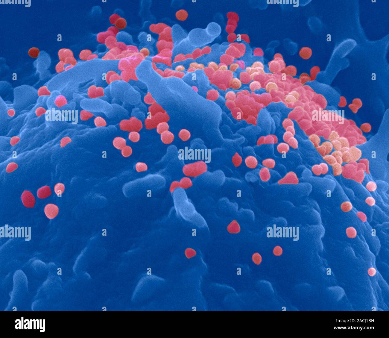 Budding HIV particles. Coloured scanning electron micrograph (SEM) of HIV particles (pink ...