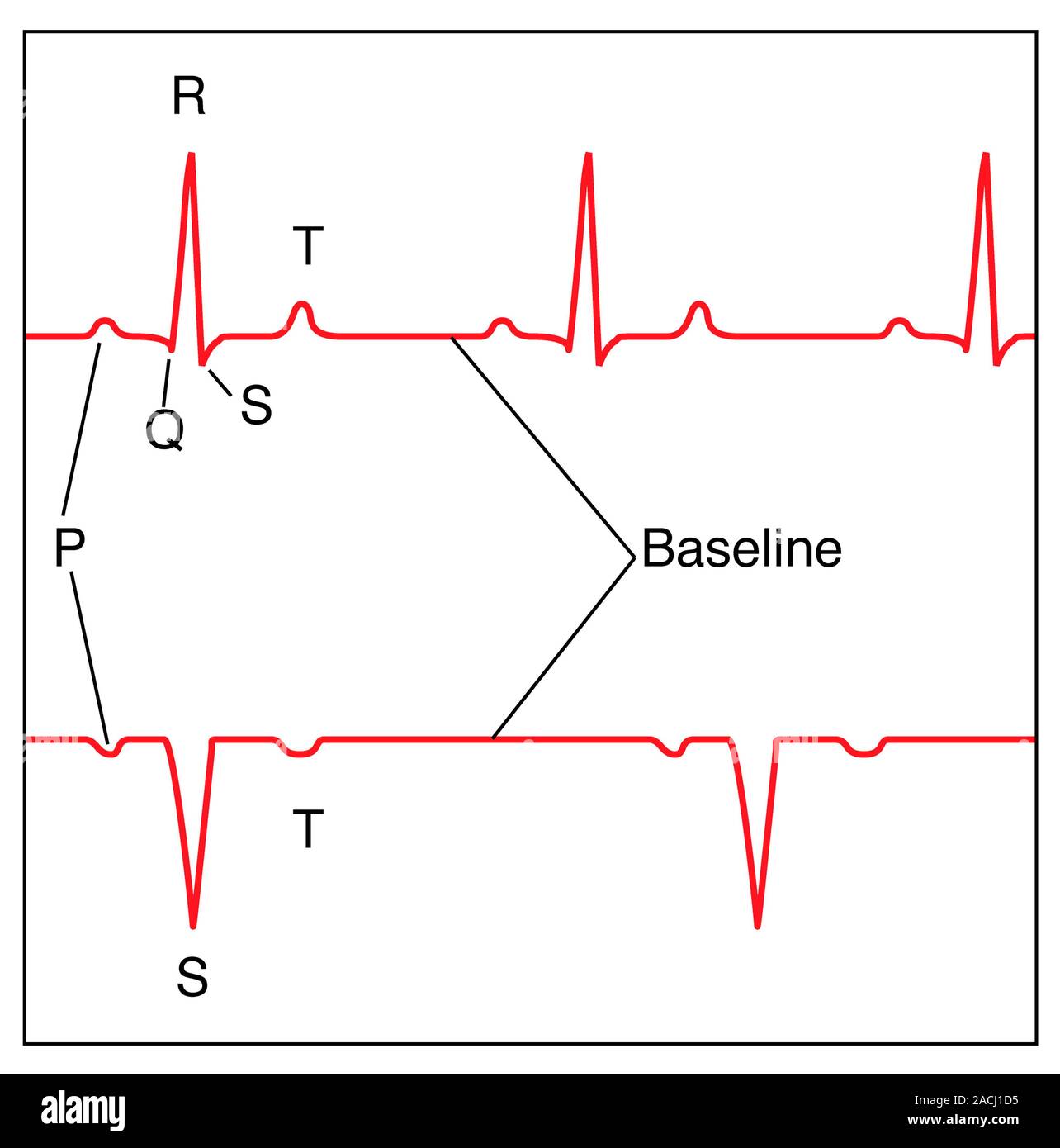 Electrocardiogram (ECG) of a normal heart rate, artwork. An ECG ...