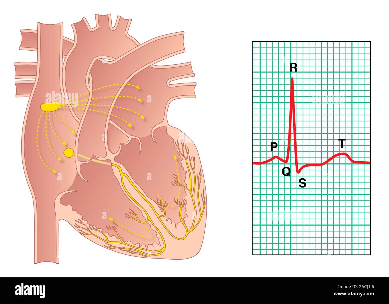 Electrical conduction of the heart. Artwork showing the impulse ...