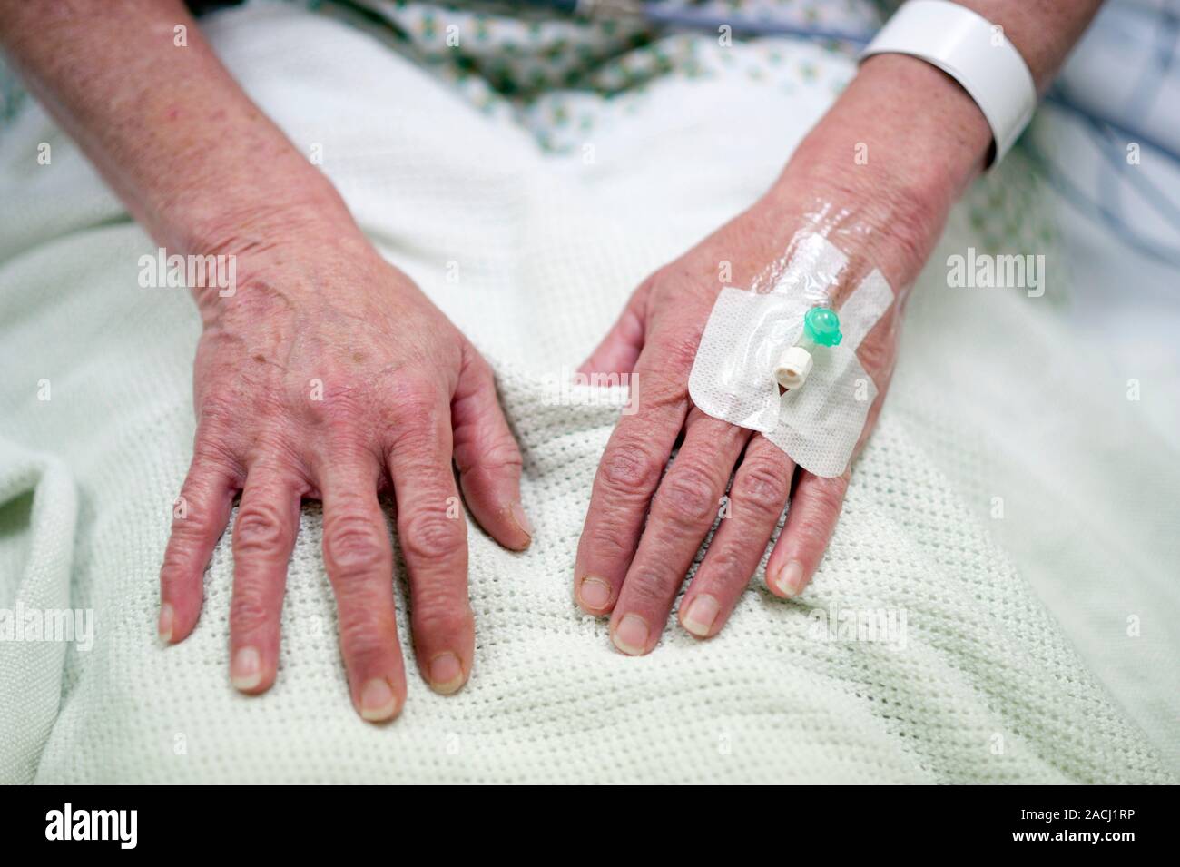 Anaesthesia preparations. Cannula in a patient's hand as they undergo ...