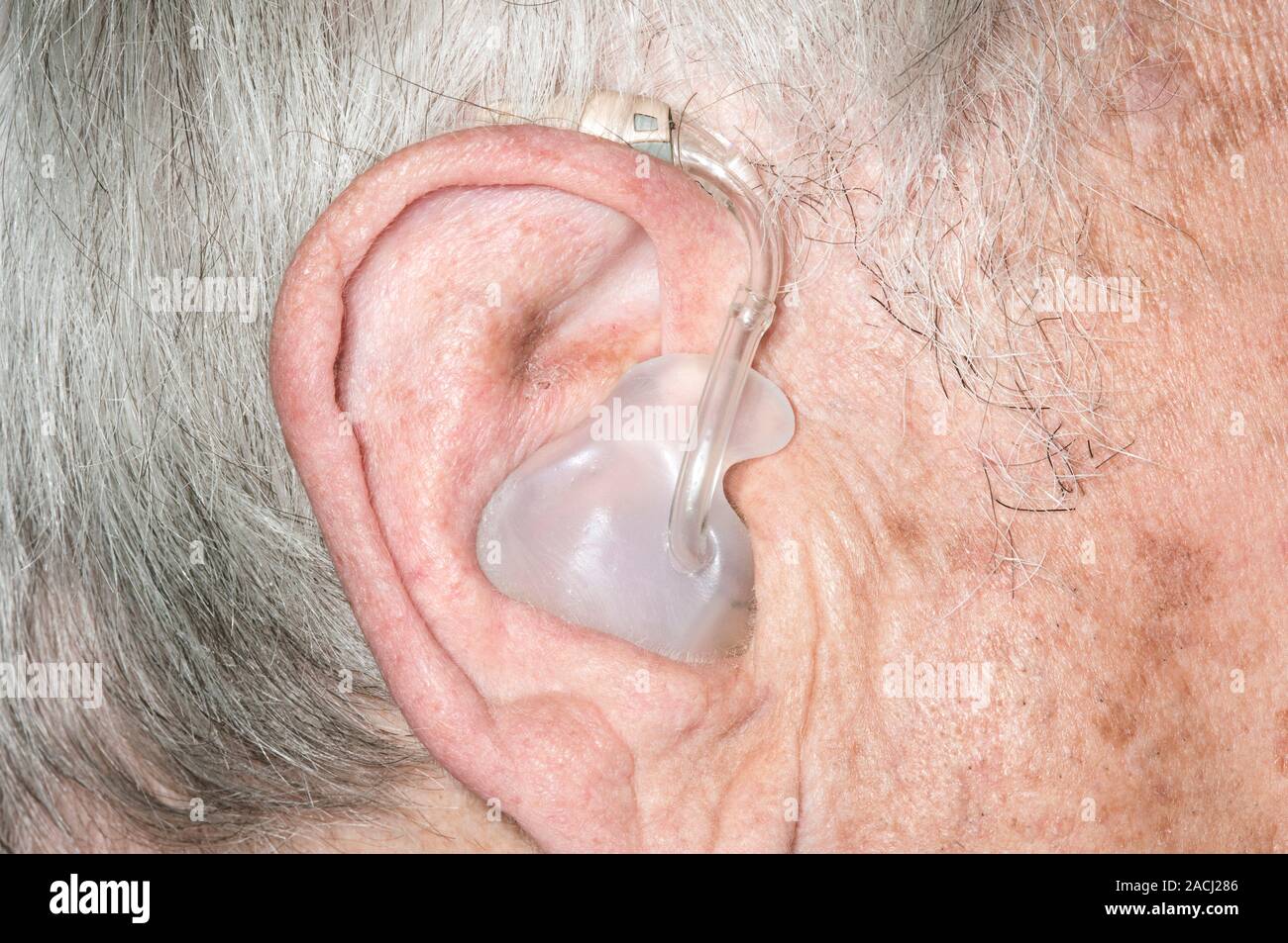 Hearing aid being worn by an 80 year old male patient. This battery ...