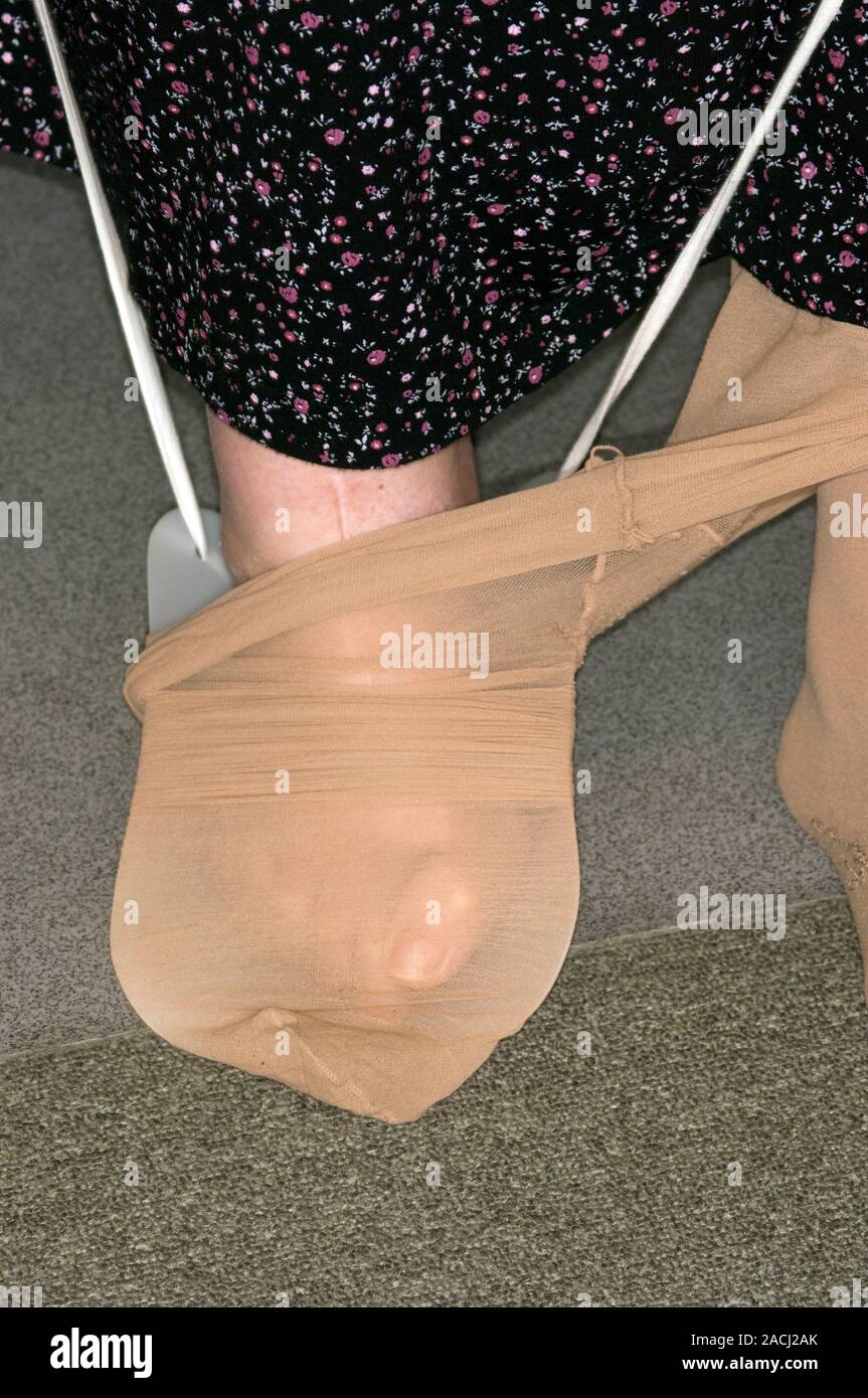 Device used to help pull on tights in a 61 year old female arthritic ...