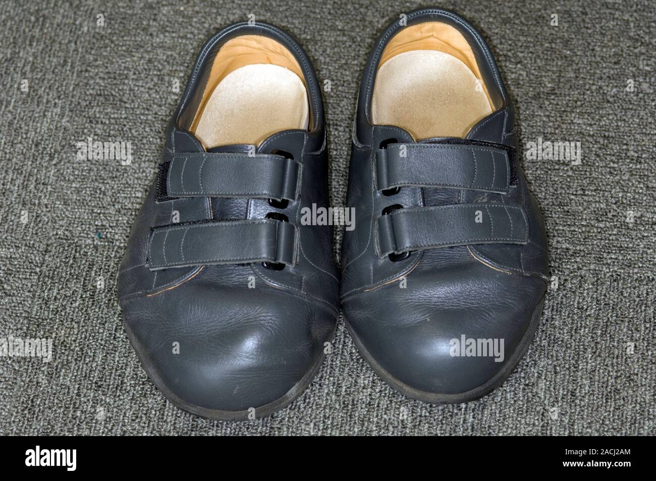 Surgical shoes for a 61 year old female patient who has rheumatoid ...