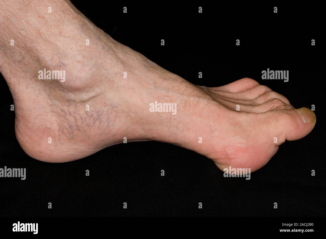Claw foot store
