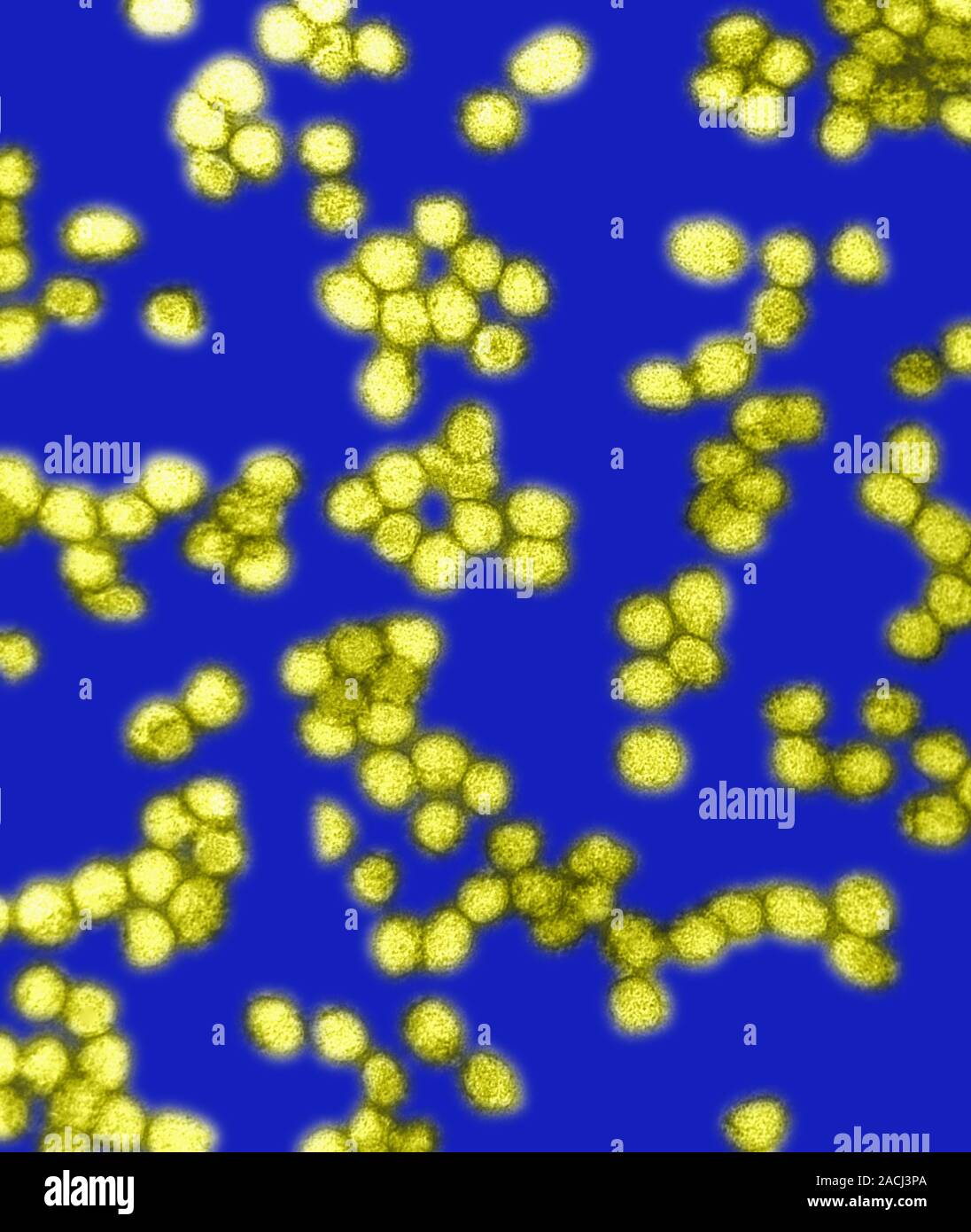 This Micrograph Shows Multiple Virions Of The Yellow Fever Virus At A Magnification Of X234000
