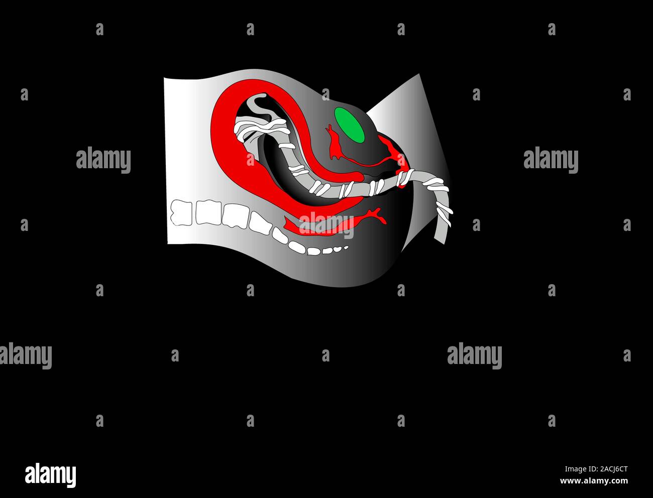 Placental expulsion, artwork. This is the third stage of labour, which ...