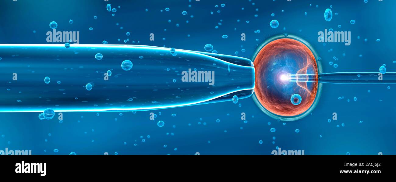 In-vitro fertilisation (IVF). Artwork showing a human egg cell (ovum ...