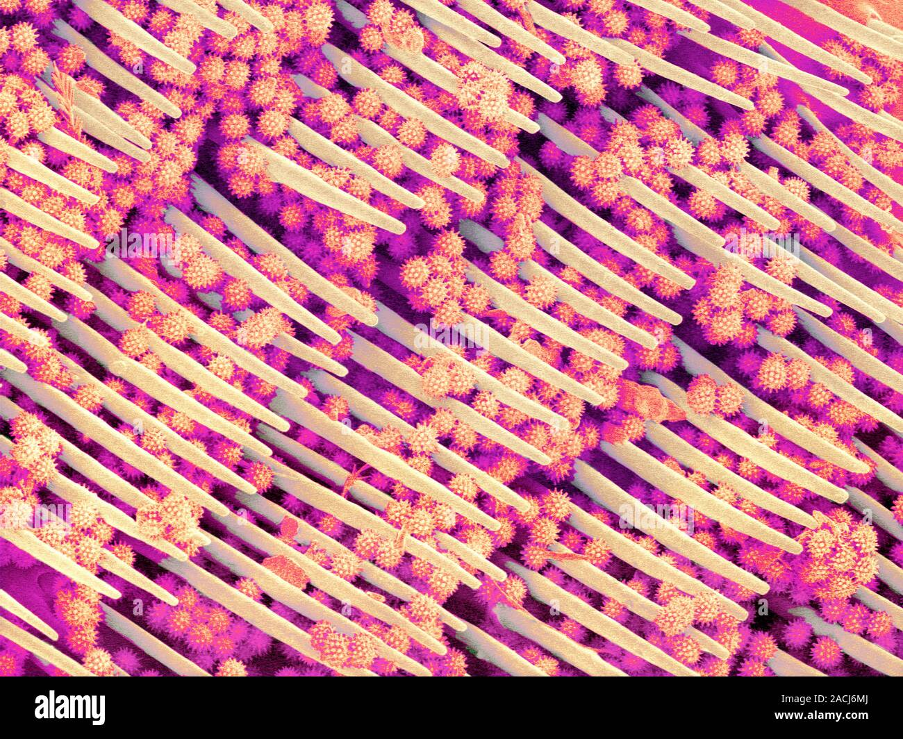 Honey bee leg. Coloured scanning electron micrograph (SEM) of the leg ...
