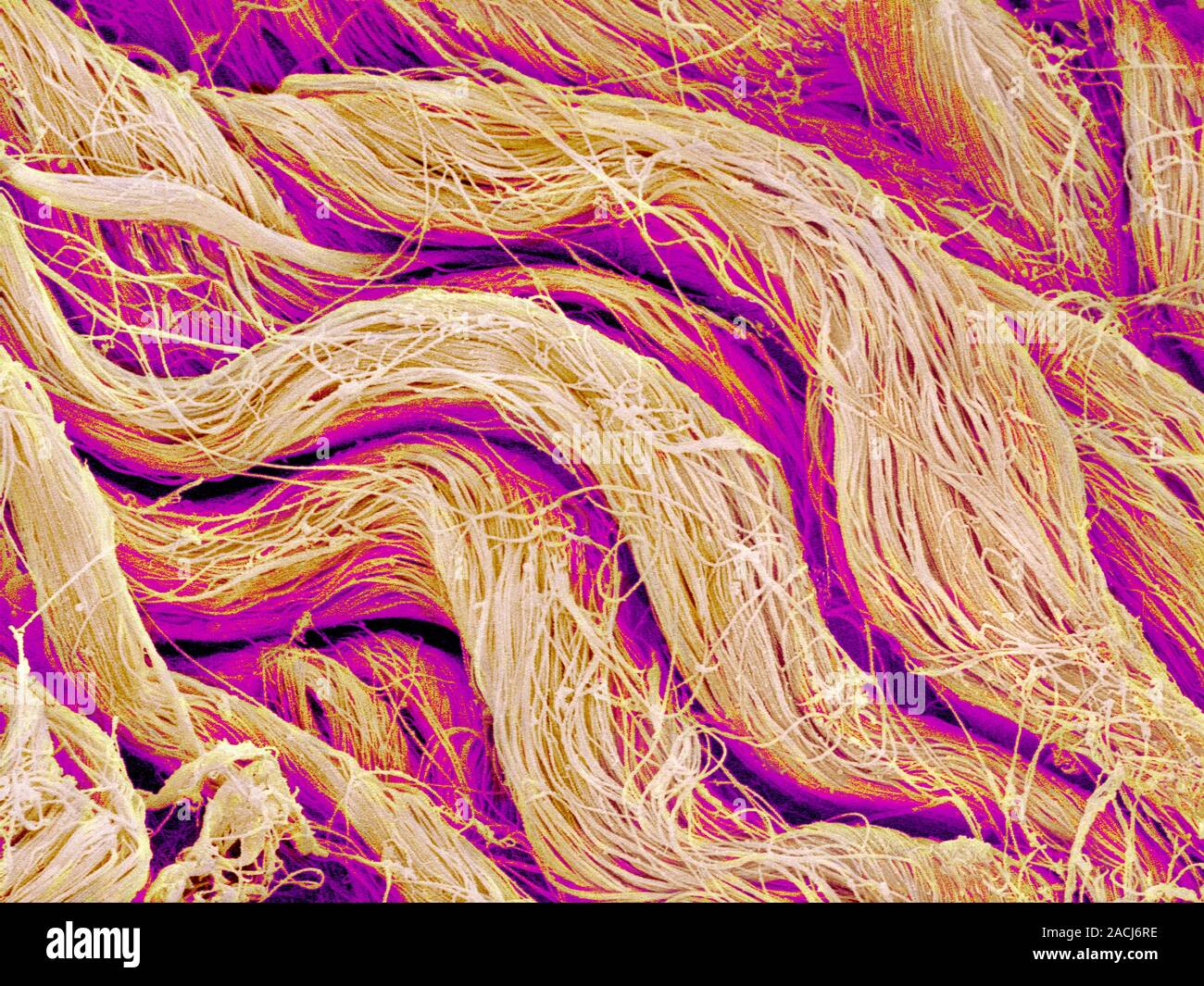 Collagen fibres. Coloured scanning electron micrograph (SEM) of ...