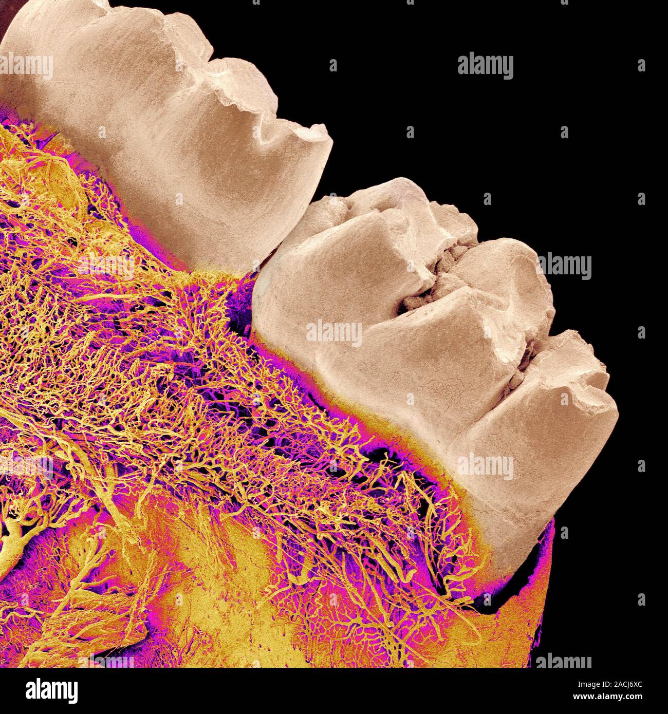 Rat molars, coloured scanning electron micrograph (SEM). Rats have 12 ...
