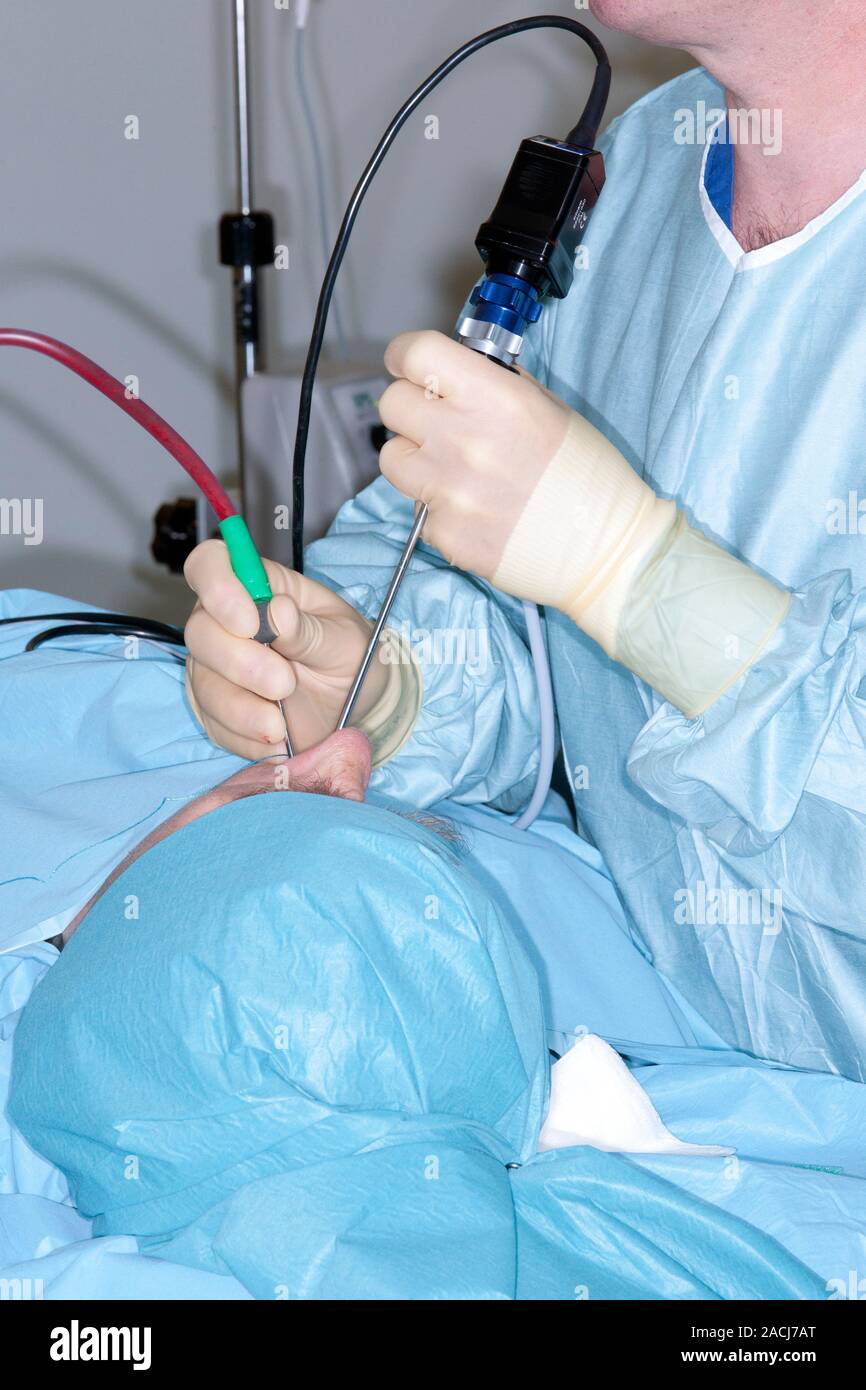 Nasal Polyp Surgery Surgeon Using Endoscopic Tools To Excise A Polyp