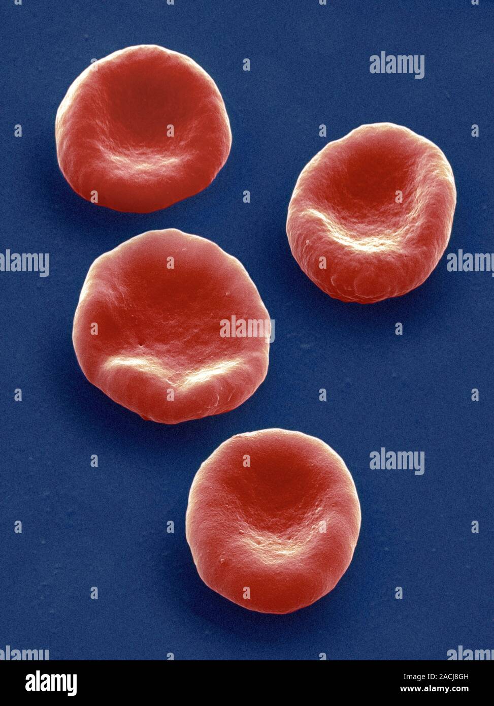 Red blood cells. Coloured scanning electron micrograph (SEM) of human ...