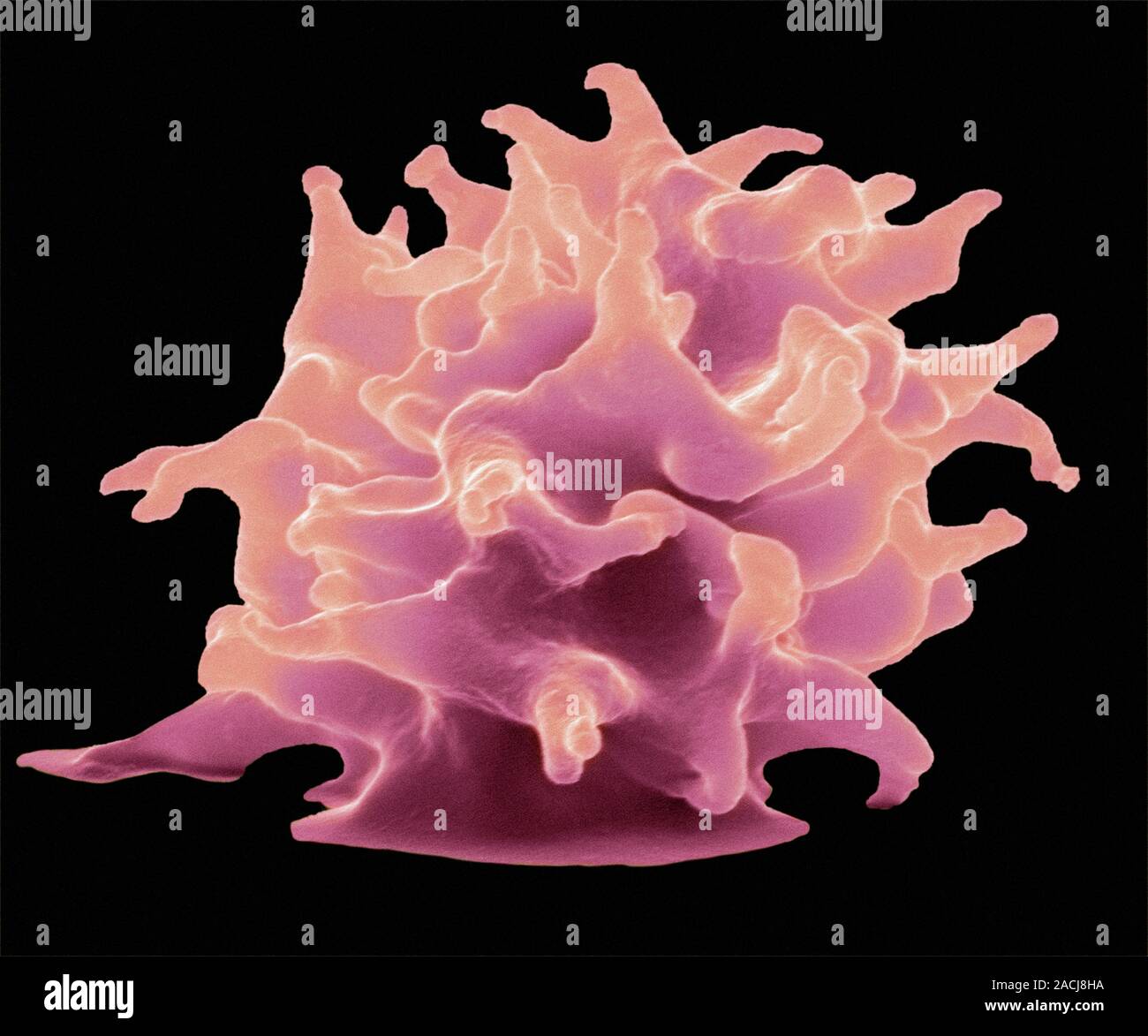 Crenated red blood cell. Coloured scanning electron micrograph (SEM) of ...