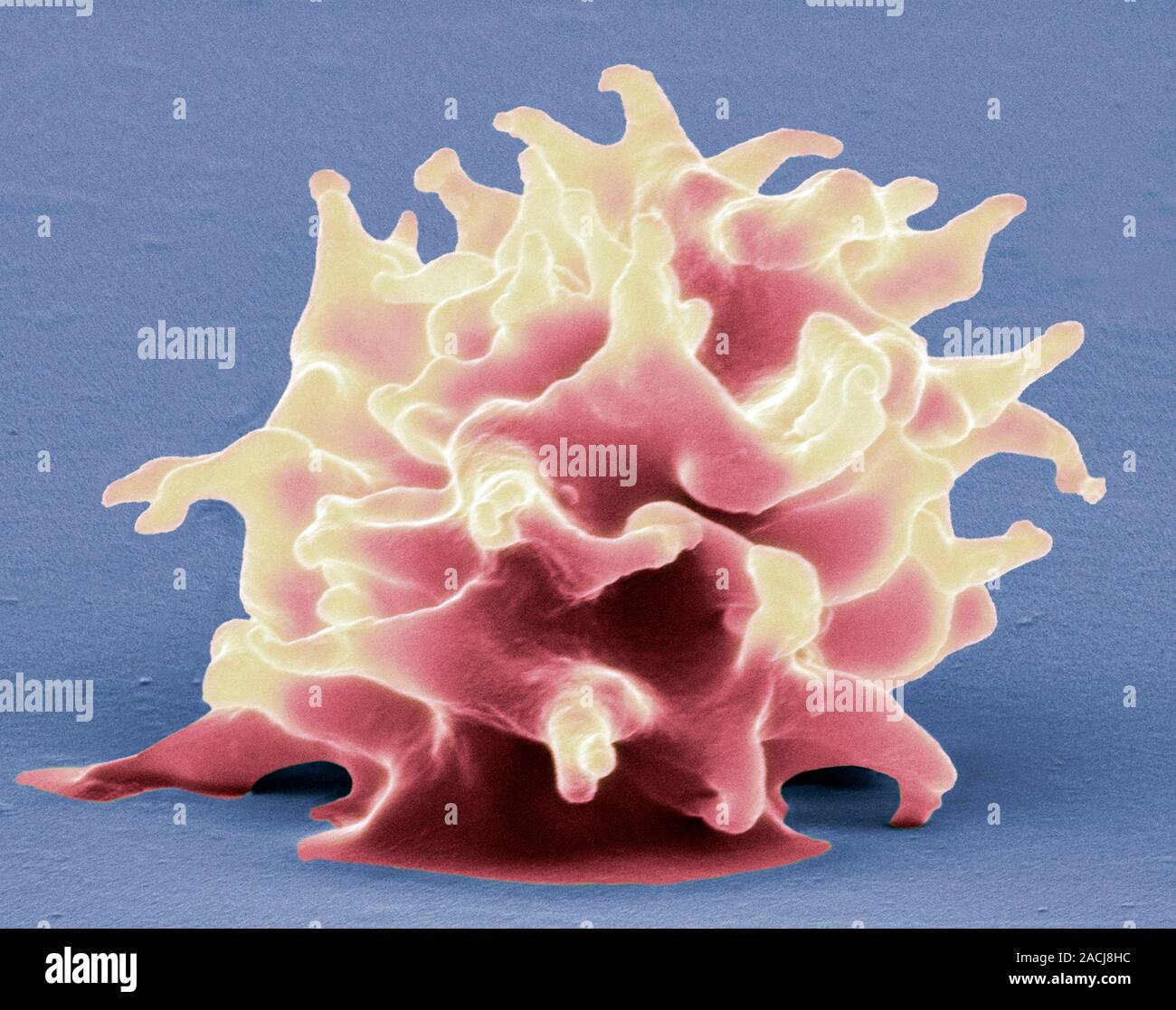 Crenated red blood cell. Coloured scanning electron micrograph (SEM) of ...