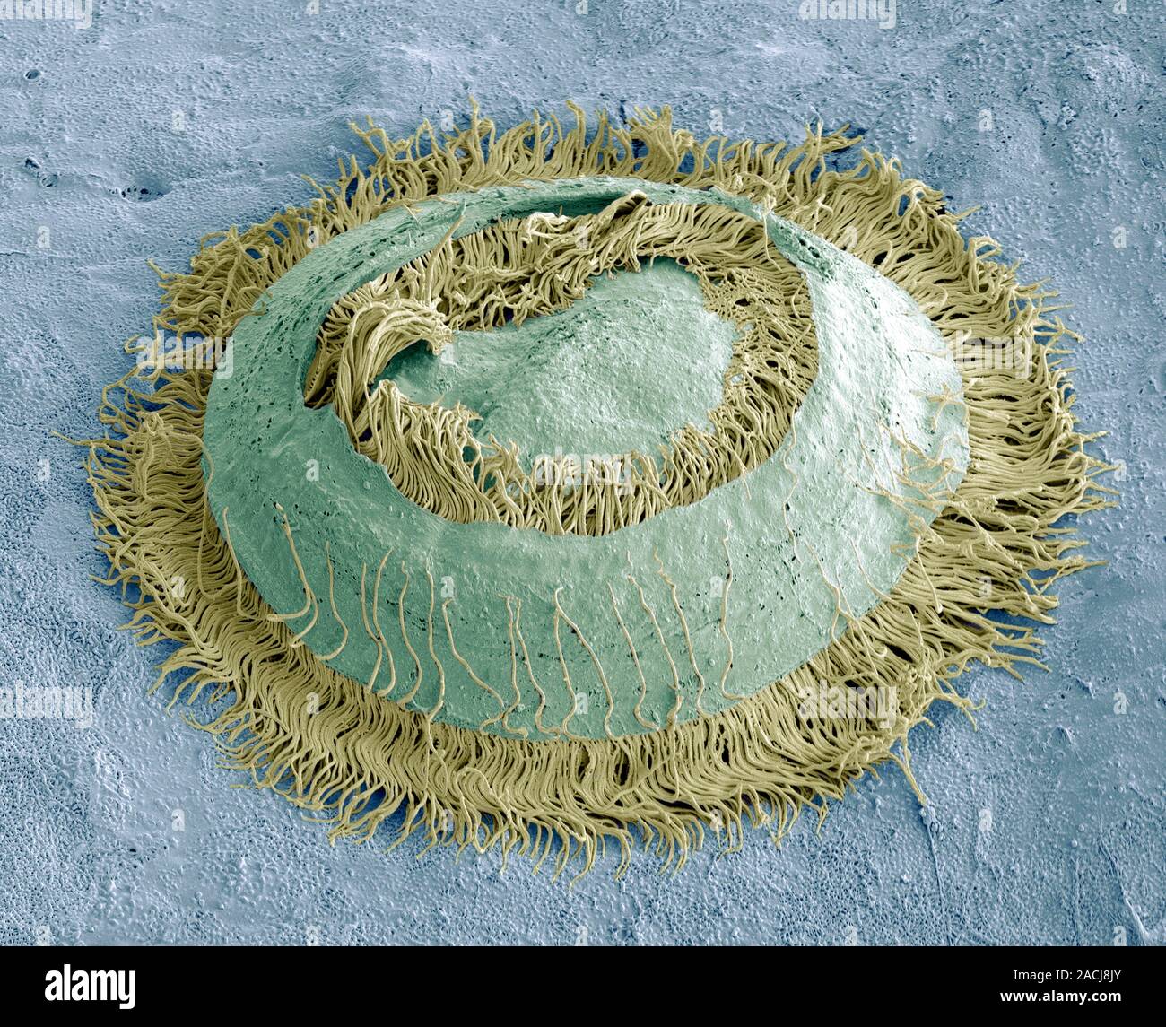 Trichodina parasite. Coloured scanning electron micrograph (SEM) of a ...